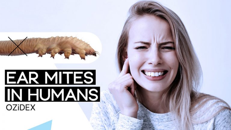 Ear Mites in Humans: Symptoms, Prevention, and Treatment | Ozidex